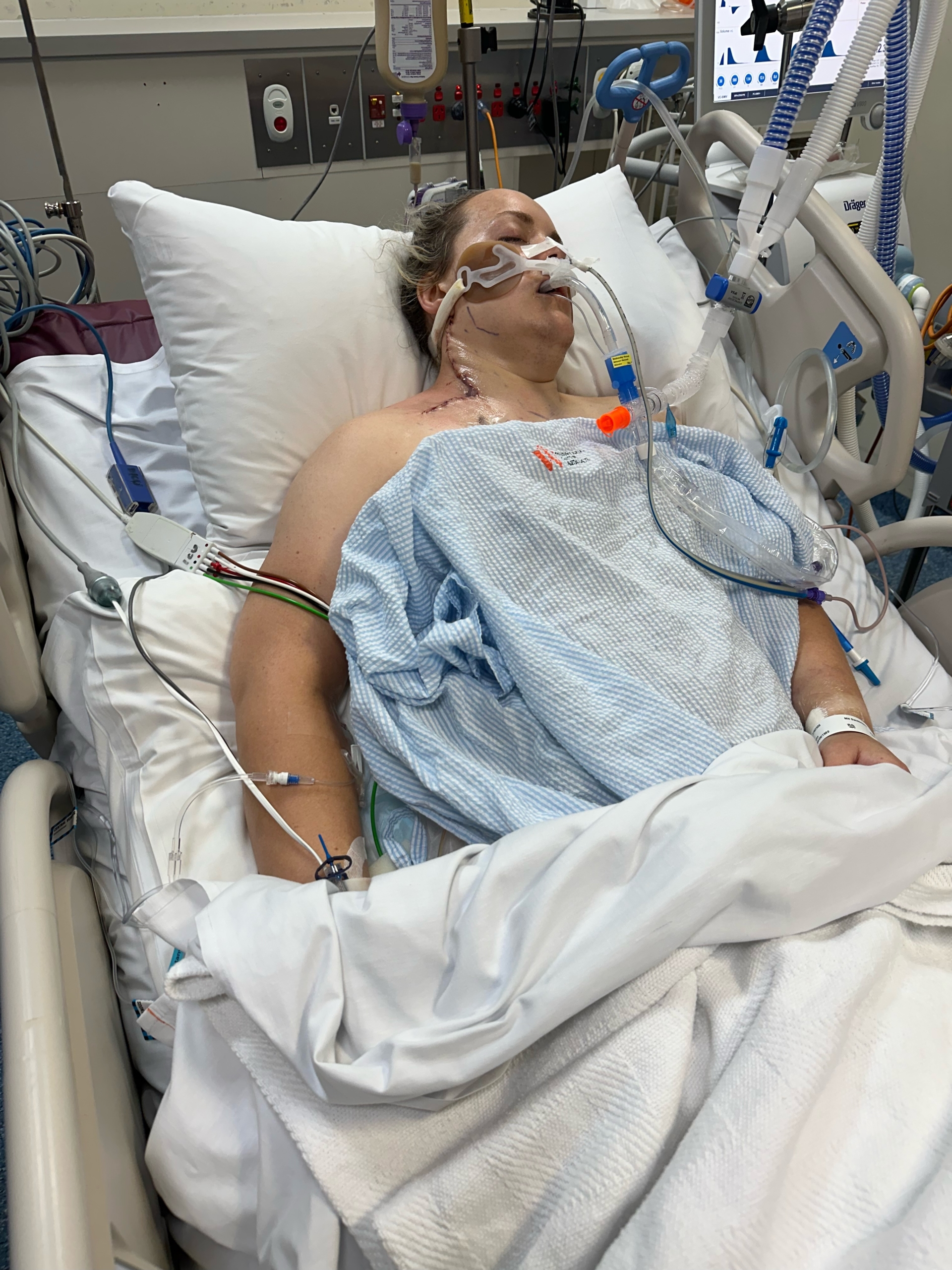 Sam Boag – Sepsis Australia