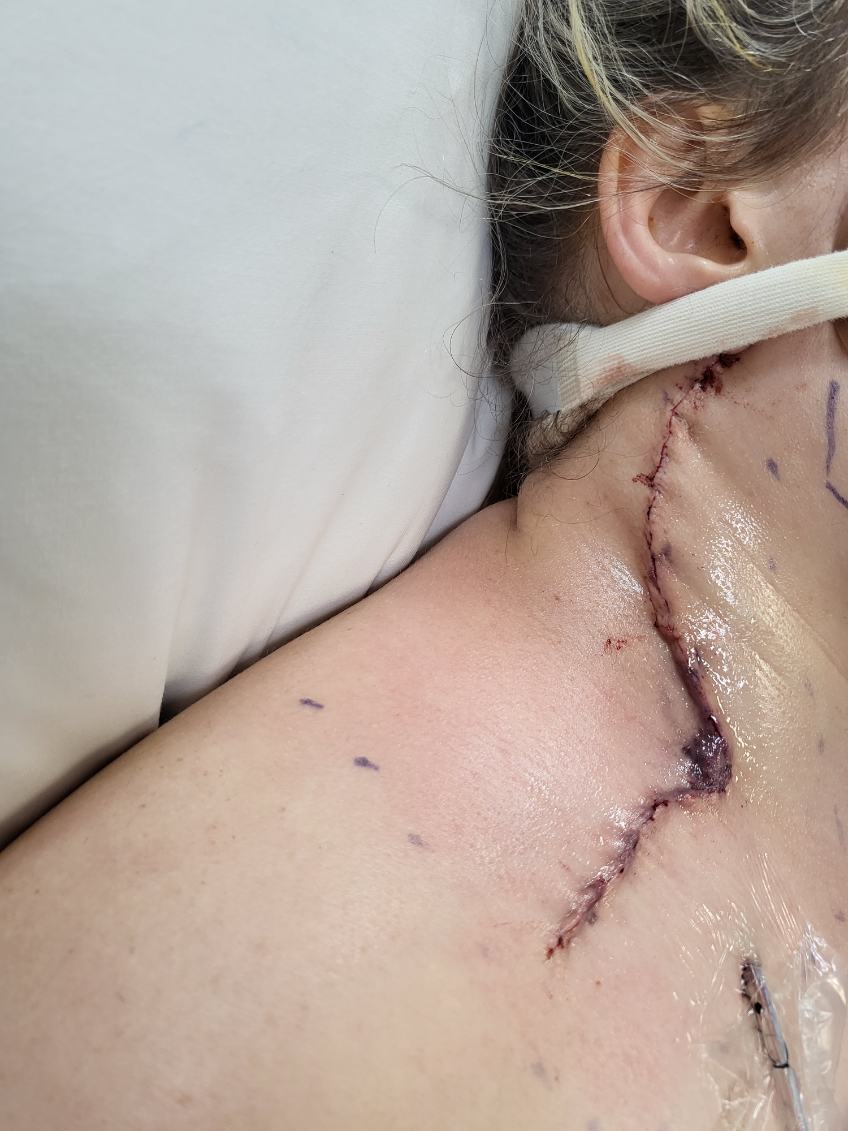 Sam Boag – Sepsis Australia